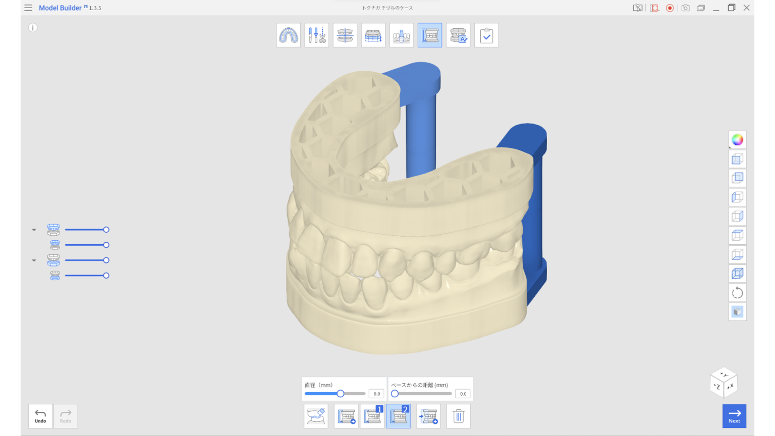 歯科用CADソフト、MeditLinkを使ってみよう② Medit Model Builder - DDI