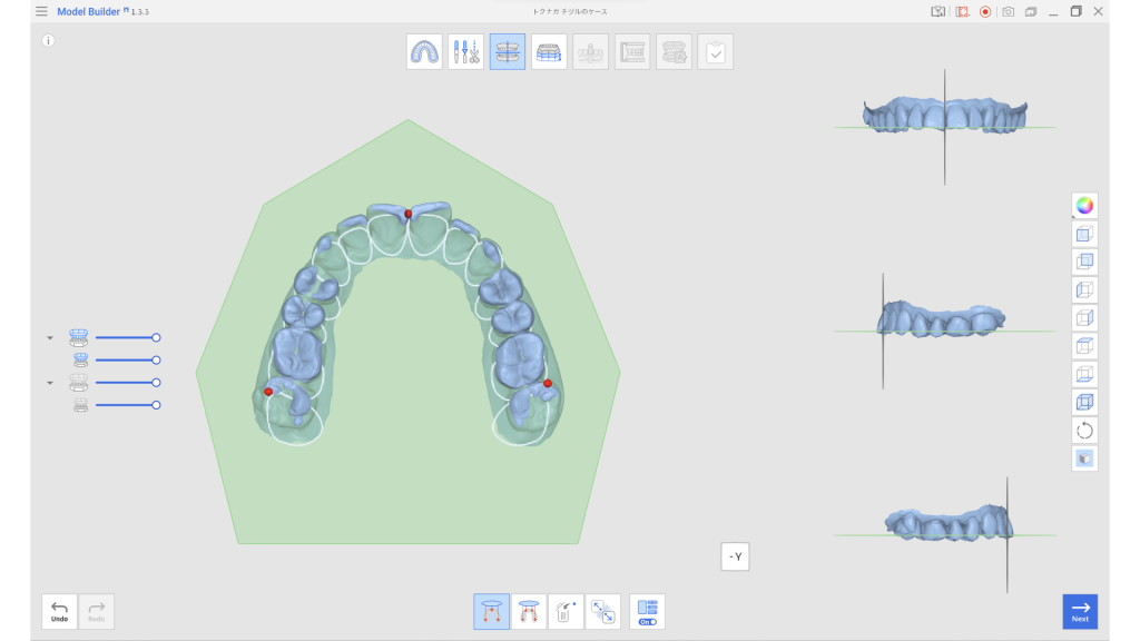 歯科用CADソフト、MeditLinkを使ってみよう② Medit Model Builder - DDI