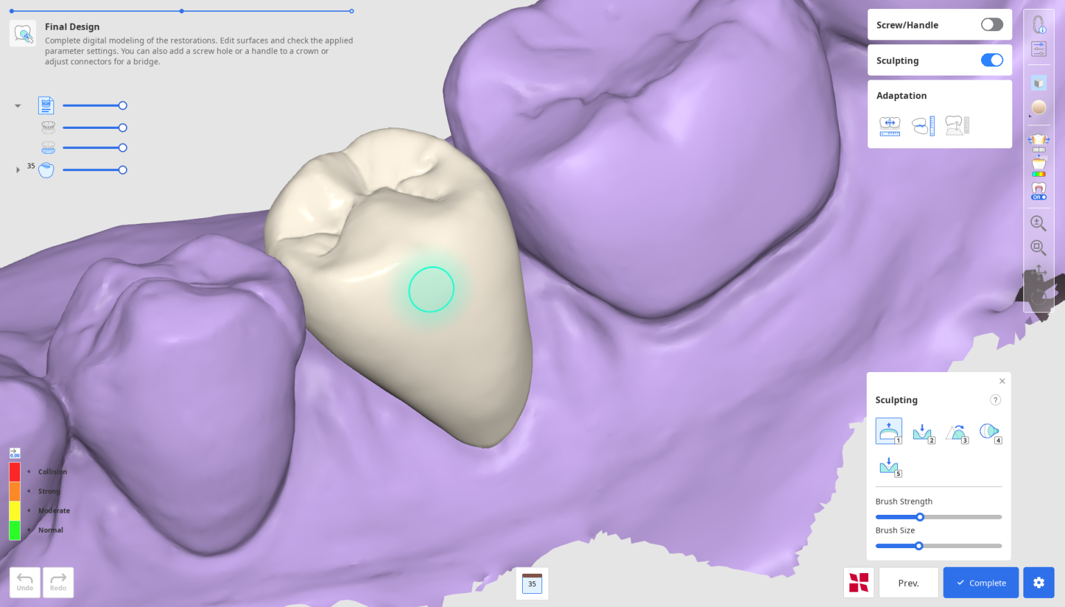 歯科用CADソフト、MeditLinkを使ってみよう① - DDI
