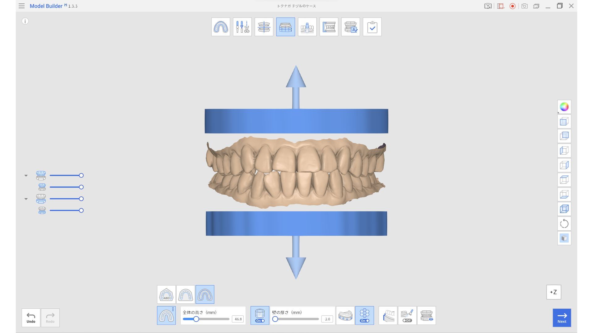 歯科用CADソフト、MeditLinkを使ってみよう② Medit Model Builder - DDI