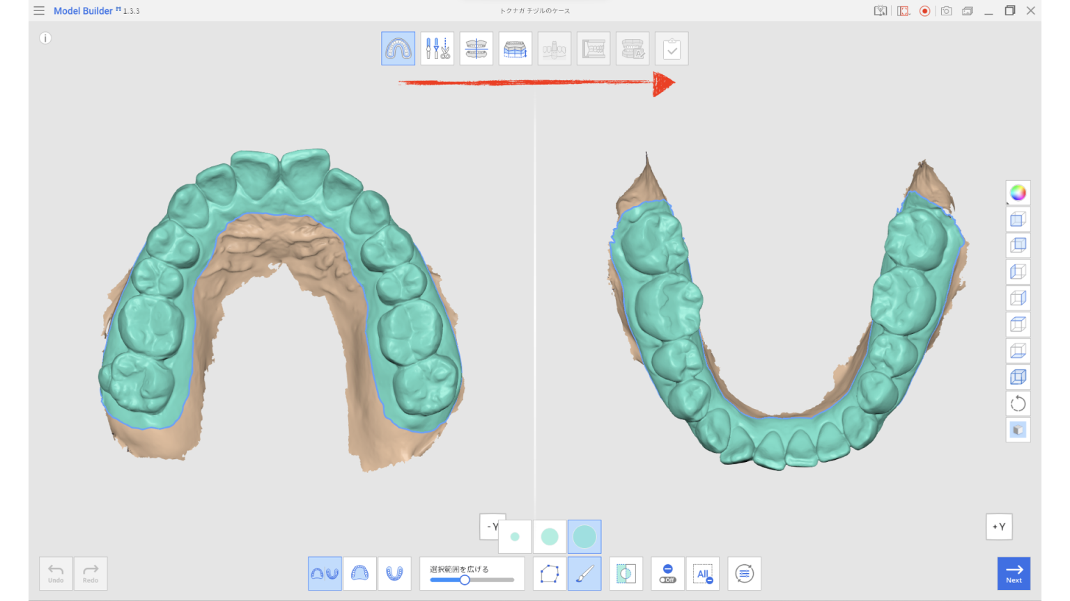 歯科用CADソフト、MeditLinkを使ってみよう② Medit Model Builder - DDI