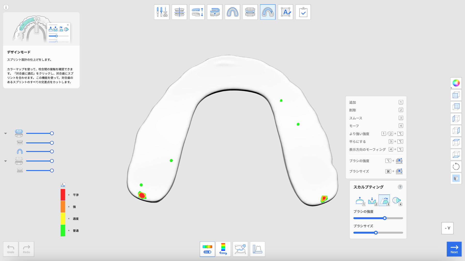 歯科用CADソフト、MeditLinkを使ってみよう④ Medit Splints - DDI