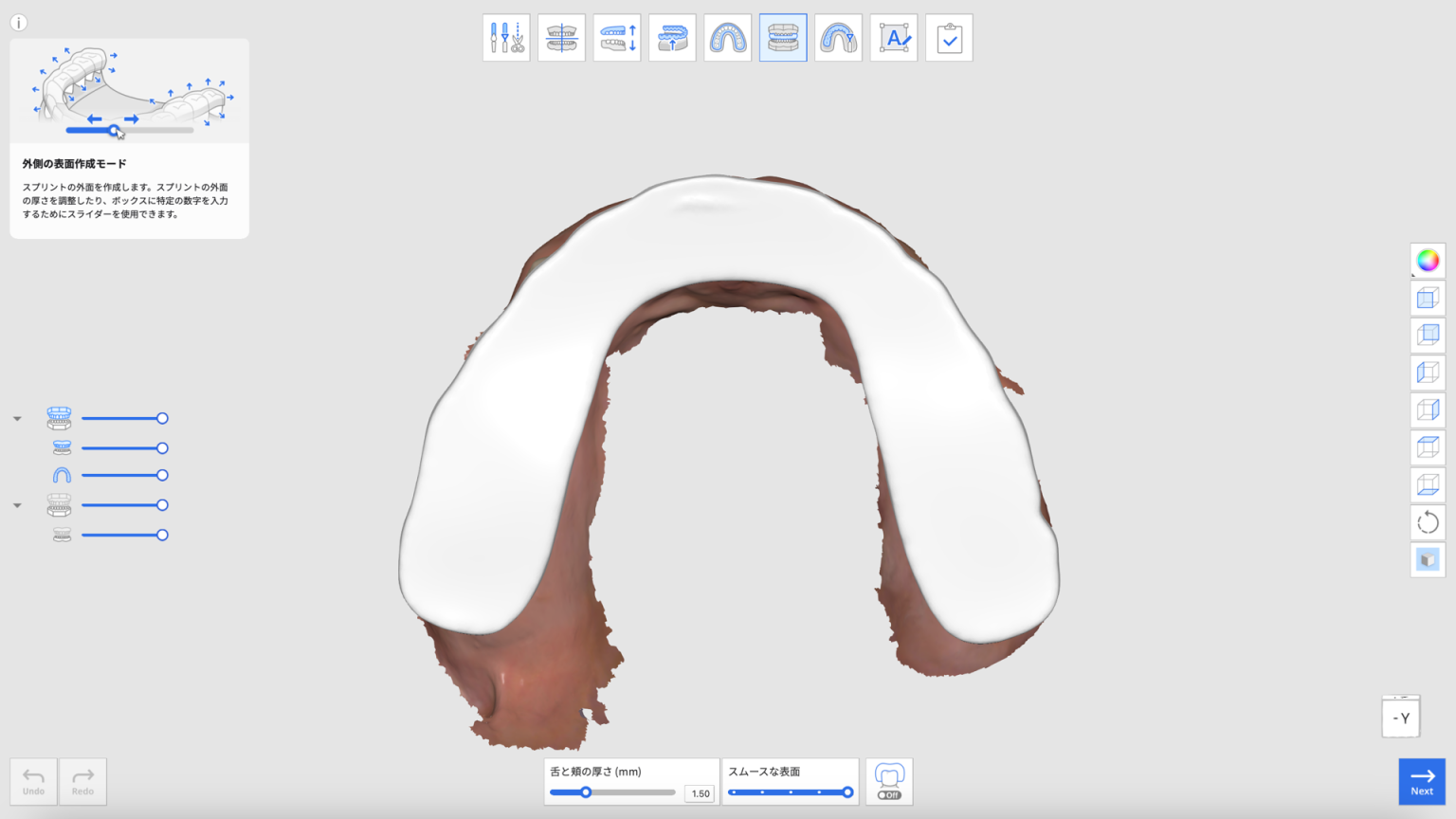 歯科用CADソフト、MeditLinkを使ってみよう④ Medit Splints - DDI