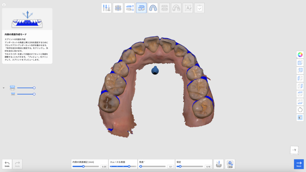 歯科用CADソフト、MeditLinkを使ってみよう④ Medit Splints - DDI