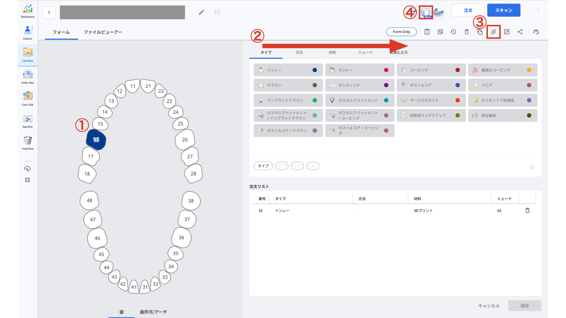 歯科用CADソフト、MeditLinkを使ってみよう③ Medit ClinicCAD[Inlay] - DDI