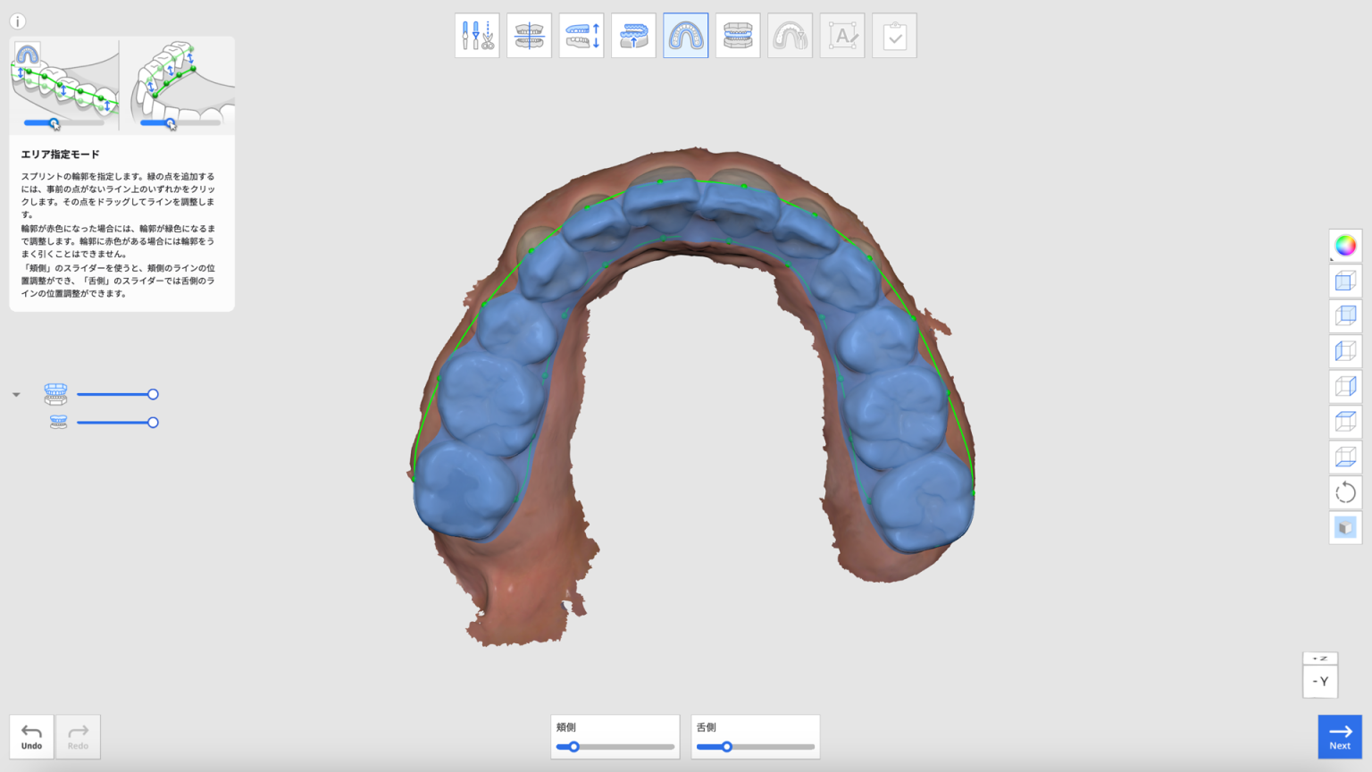歯科用CADソフト、MeditLinkを使ってみよう④ Medit Splints - DDI