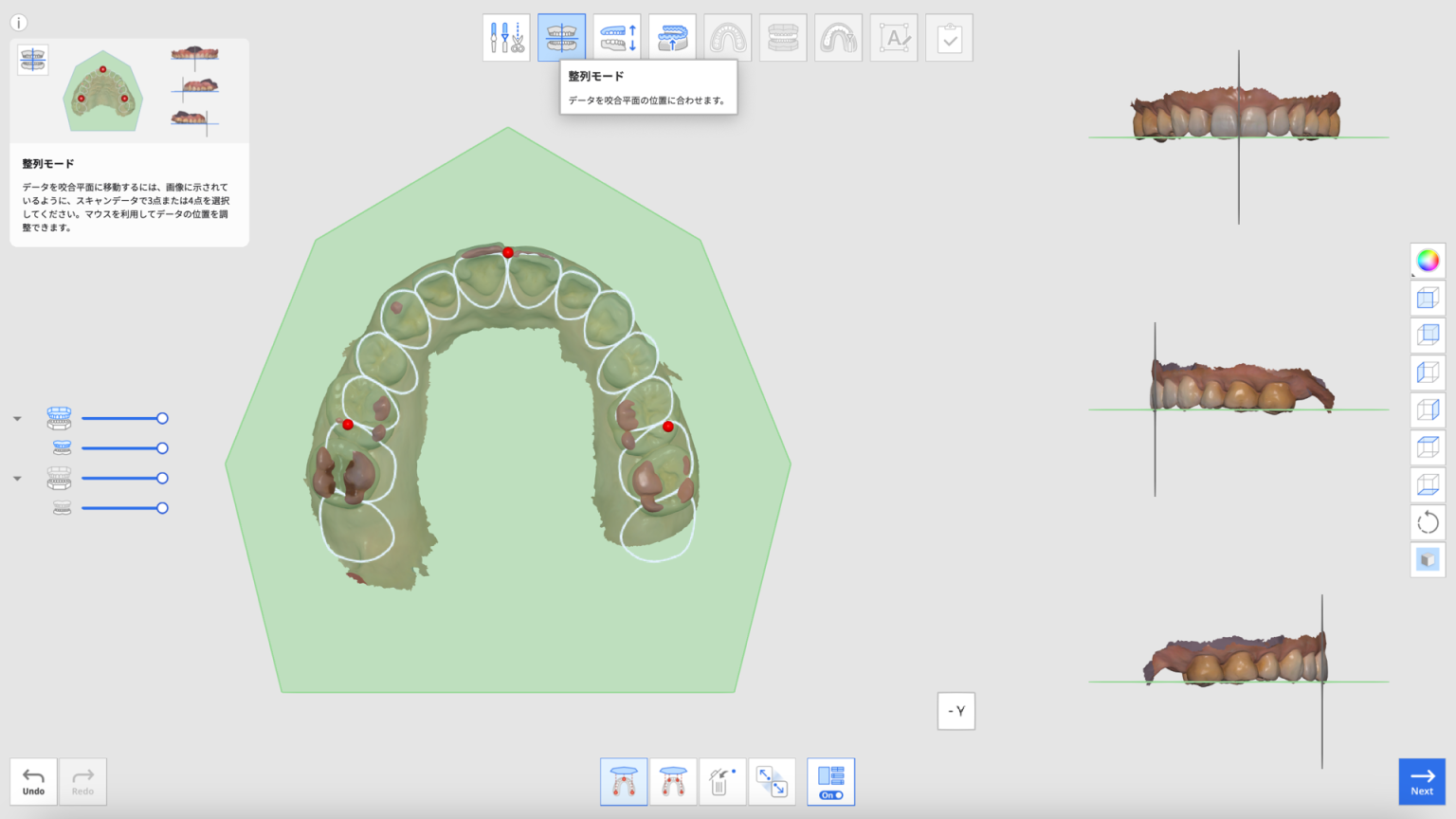 歯科用CADソフト、MeditLinkを使ってみよう④ Medit Splints - DDI