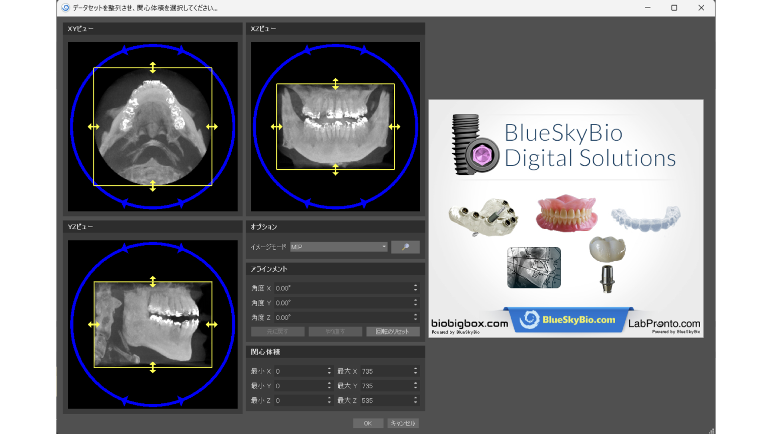フリーソフトBlue Sky Planでサージカルガイド作成 - DDI