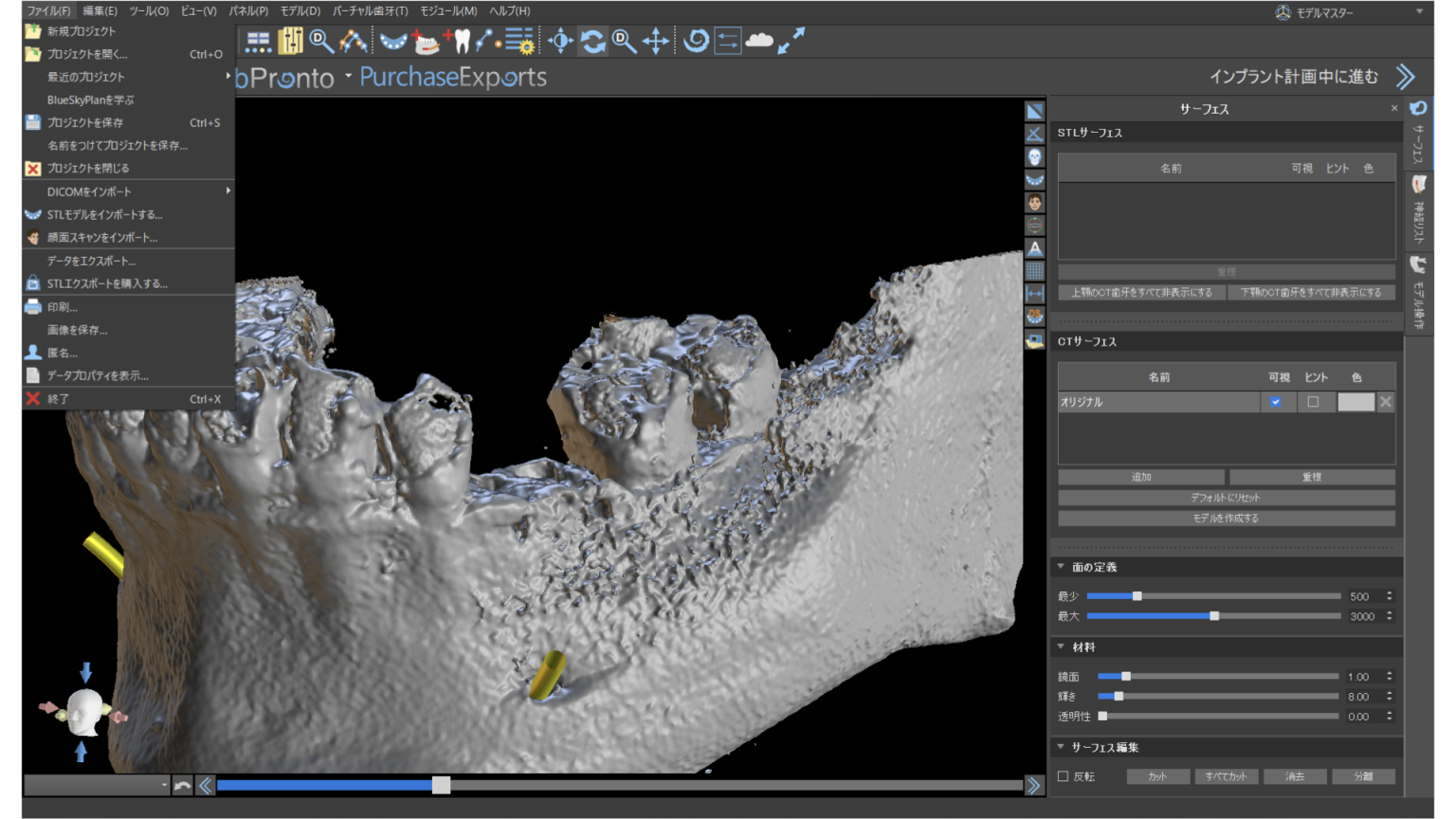 フリーソフトBlue Sky Planでサージカルガイド作成 - DDI