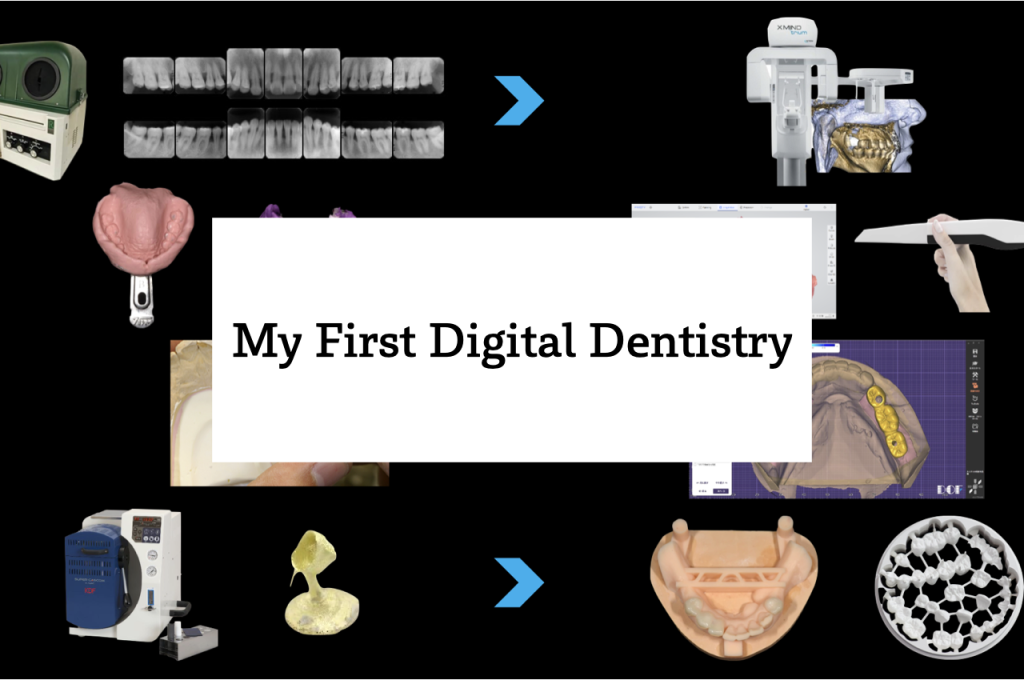My First Digital Dentistry-吉田茂治 - DDI