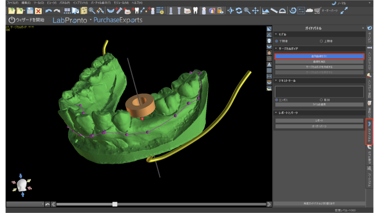 フリーソフトBlue Sky Planでサージカルガイド作成 - DDI
